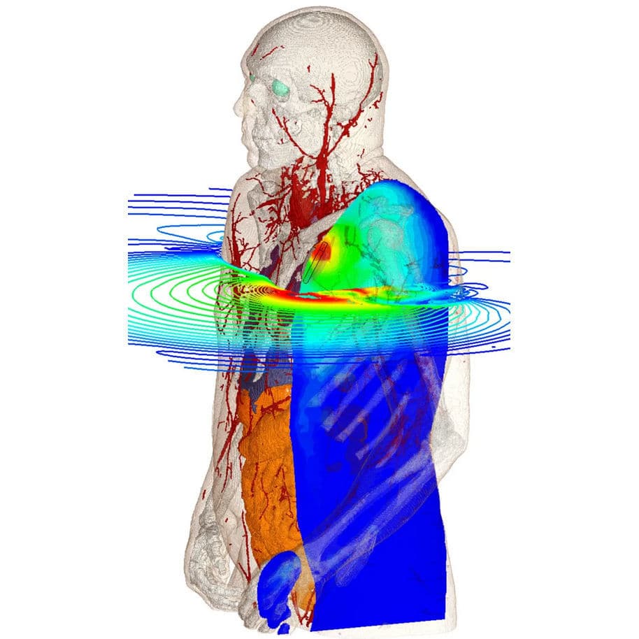 模拟软件 - Bioelectromagnetics Simulation - SIMULIA - 工程 / 测试 / 建模